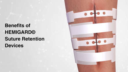 Wound Care – Biomiq